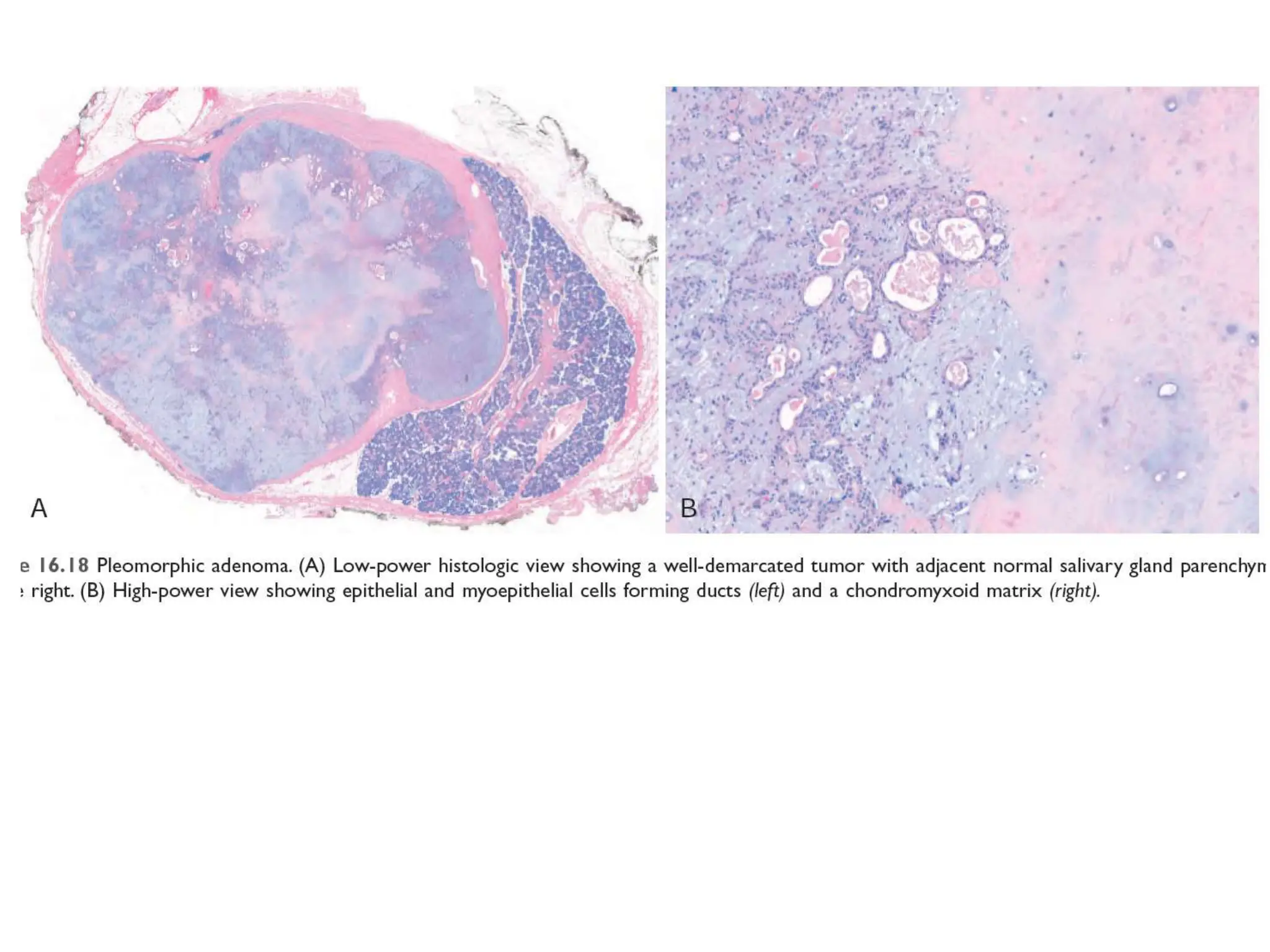 Salivary Gland.pptx