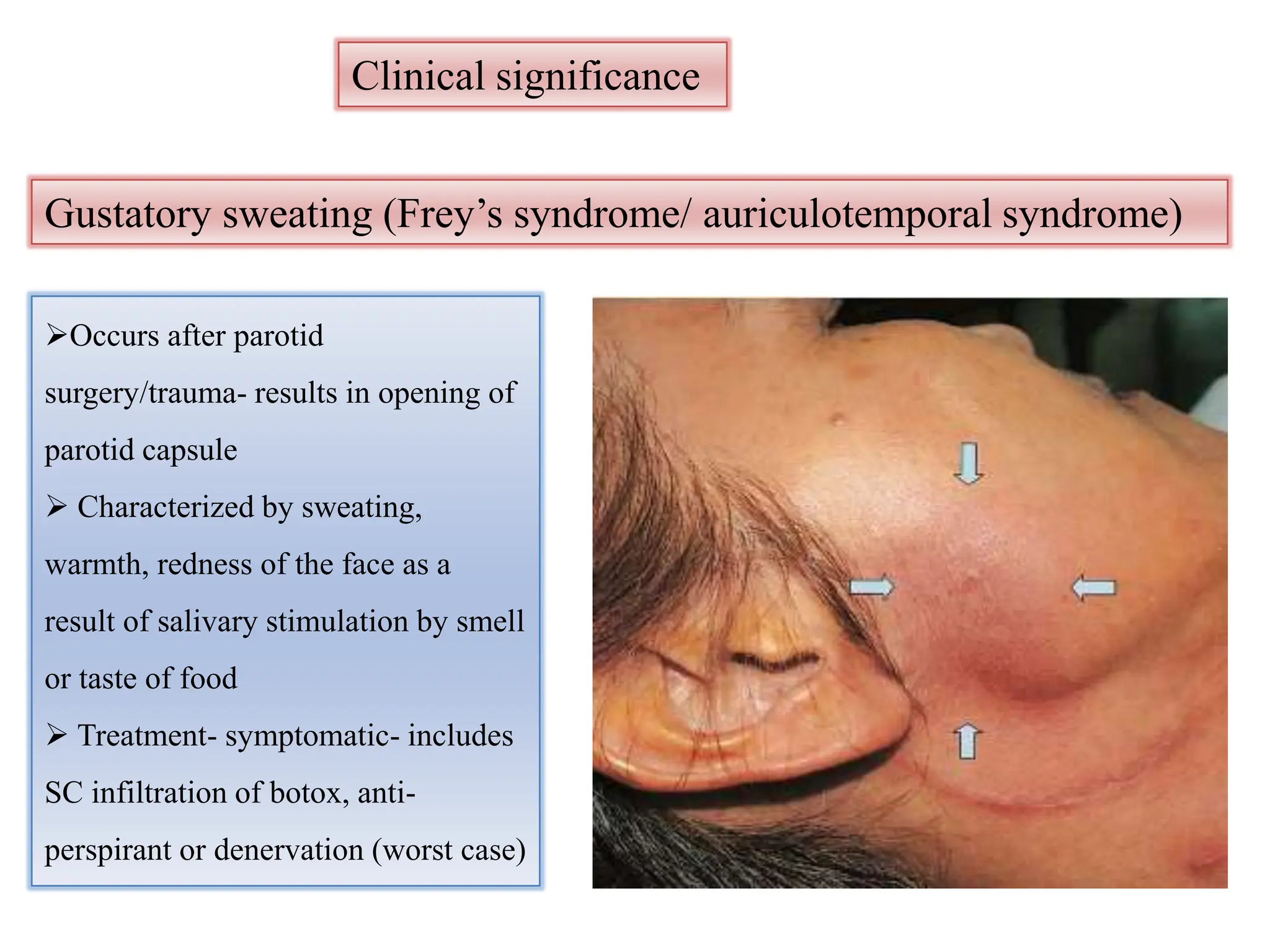Salivary gland and its importance in dentistry | PPTX | Dental Health ...