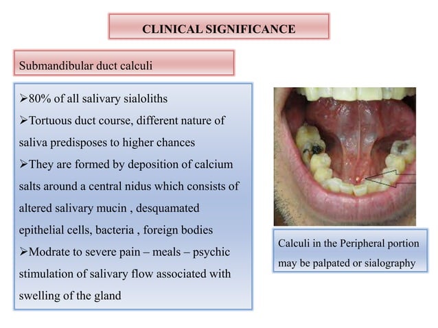 Salivary gland and its importance in dentistry | PPT