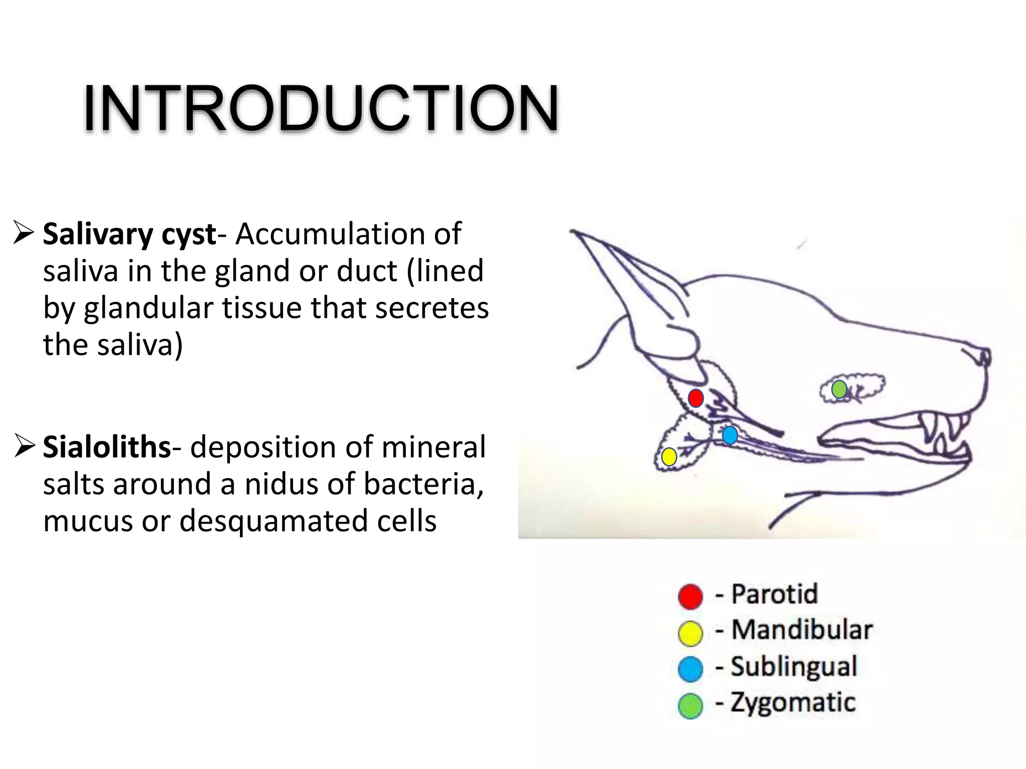 Sublingual Gland Cyst