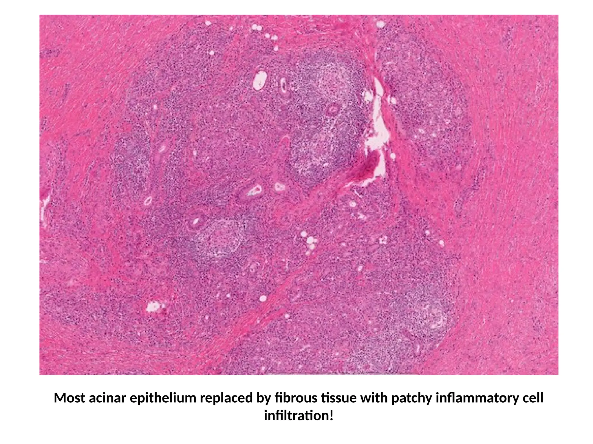 SALIVARY GLAND CYTOPATHOLOGYwith differential diagnosis (1).pptx