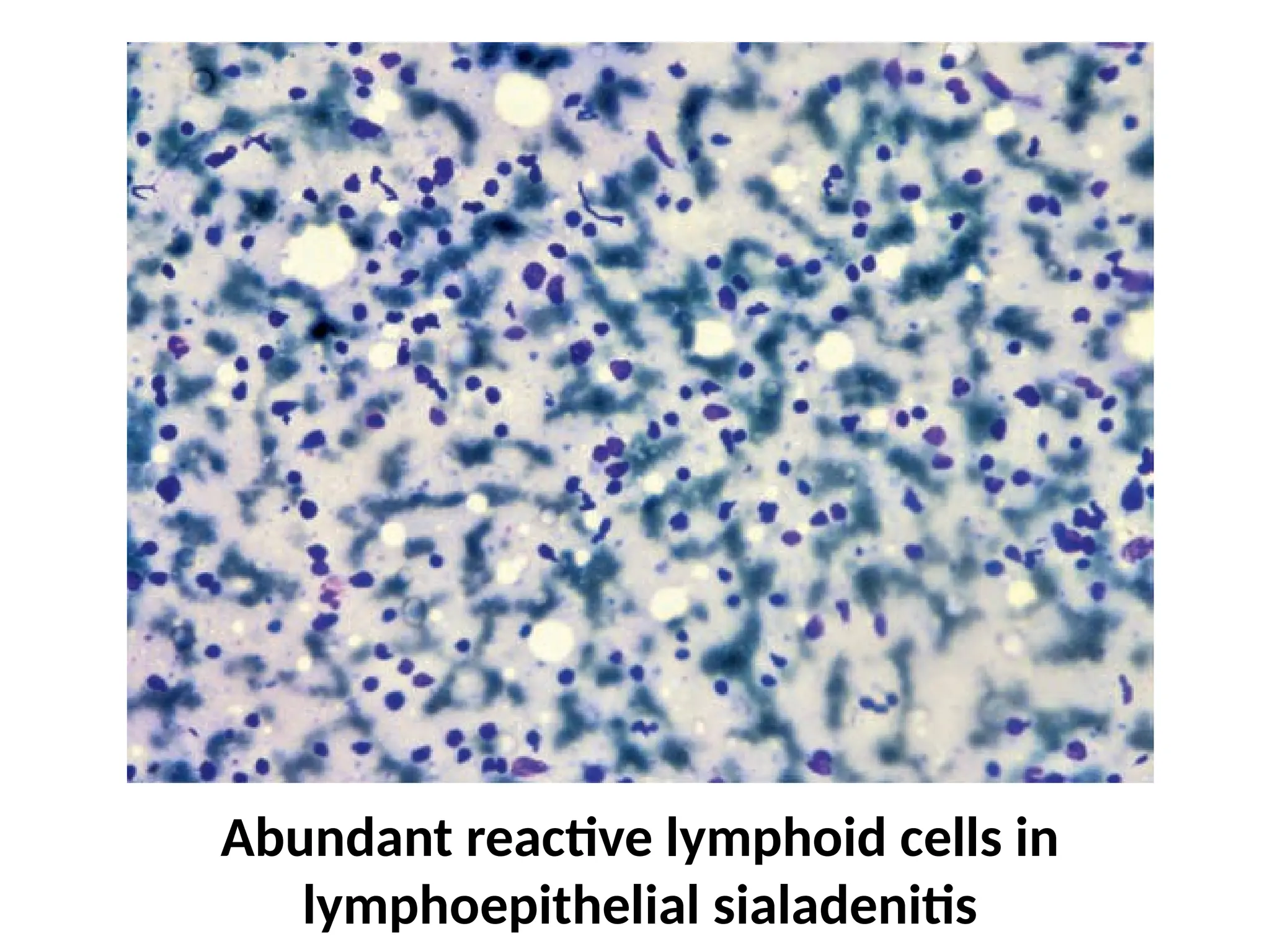 SALIVARY GLAND CYTOPATHOLOGYwith differential diagnosis (1).pptx