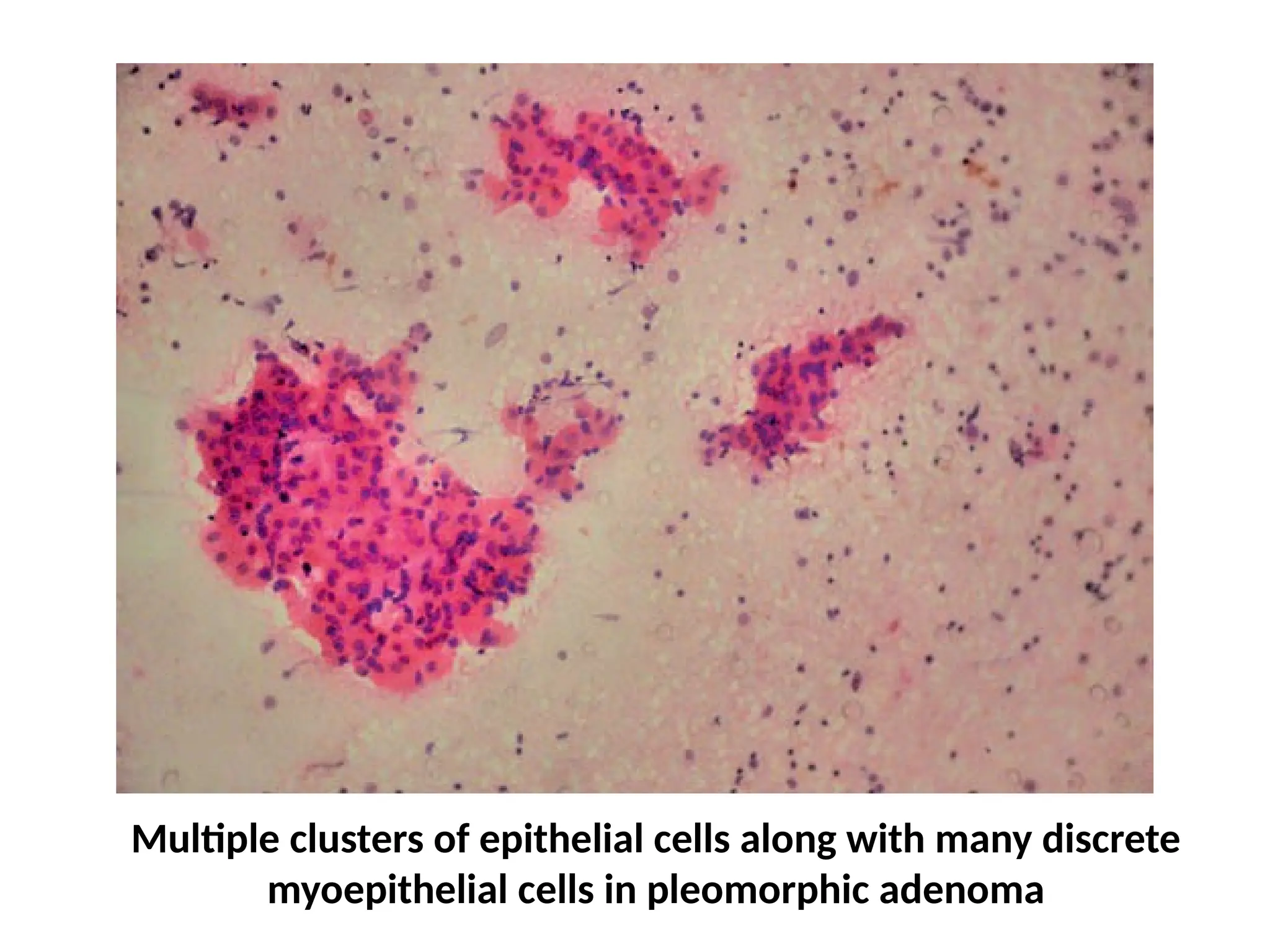 SALIVARY GLAND CYTOPATHOLOGYwith differential diagnosis (1).pptx