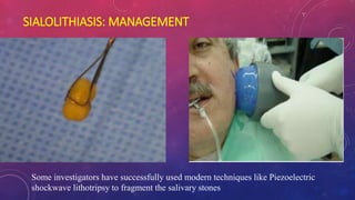 Salivary gland disease | PPTX