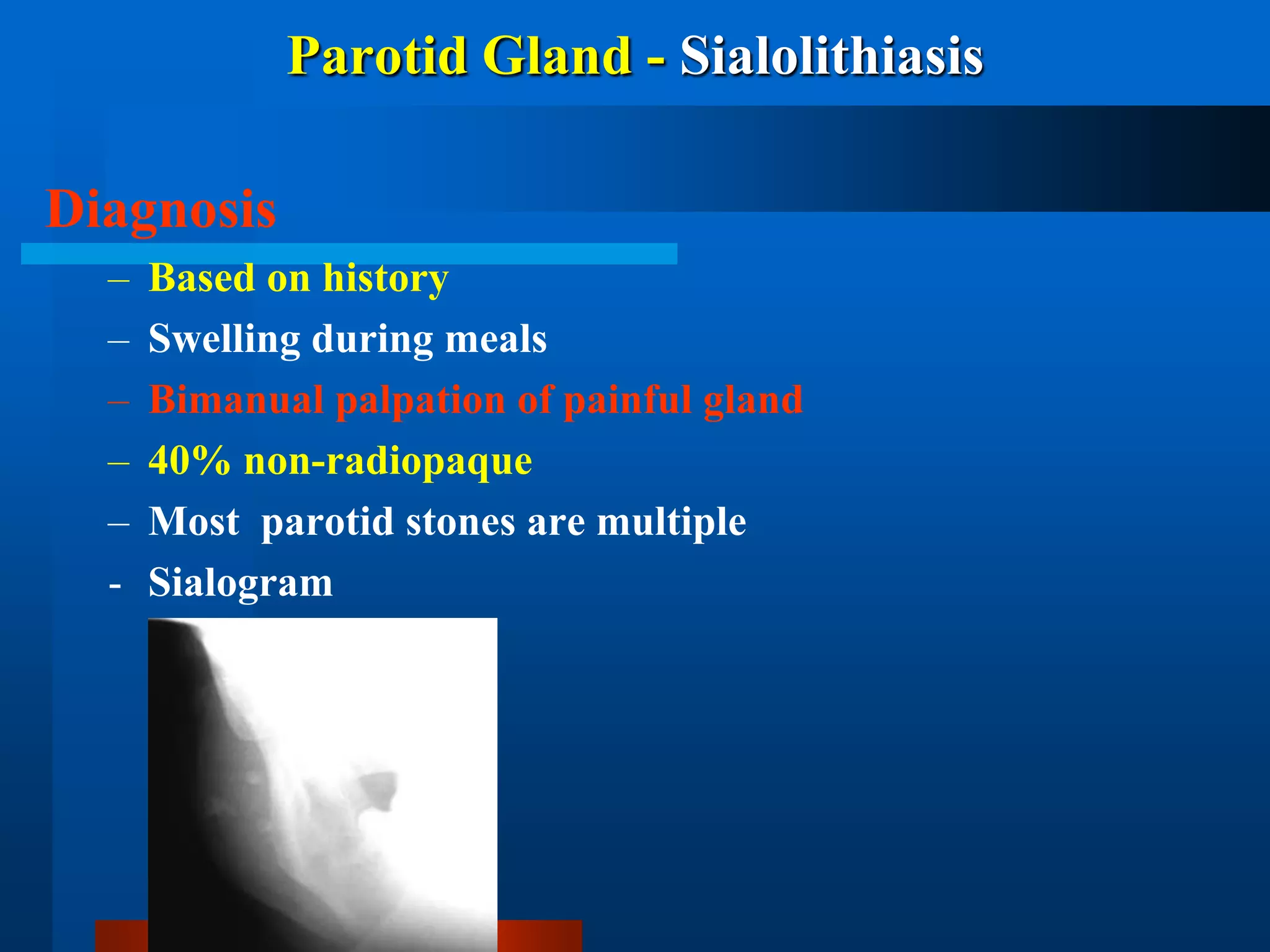 salivary_gland_disease_and_management.ppt