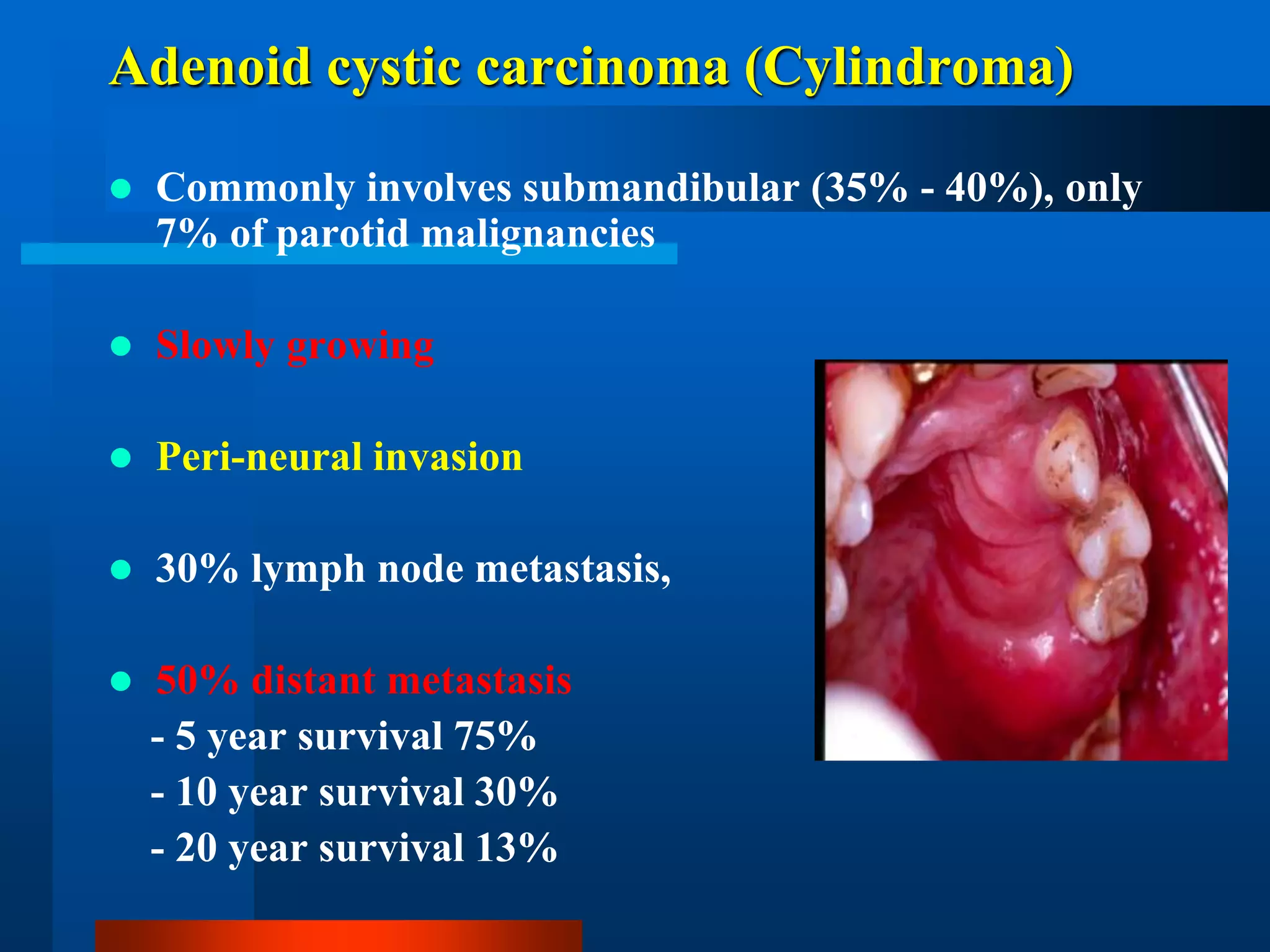 salivary_gland_disease_and_management.ppt