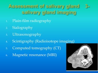 Salivary gland diseases | PPTX