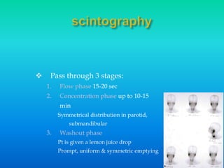 Salivary gland diseases | PPTX
