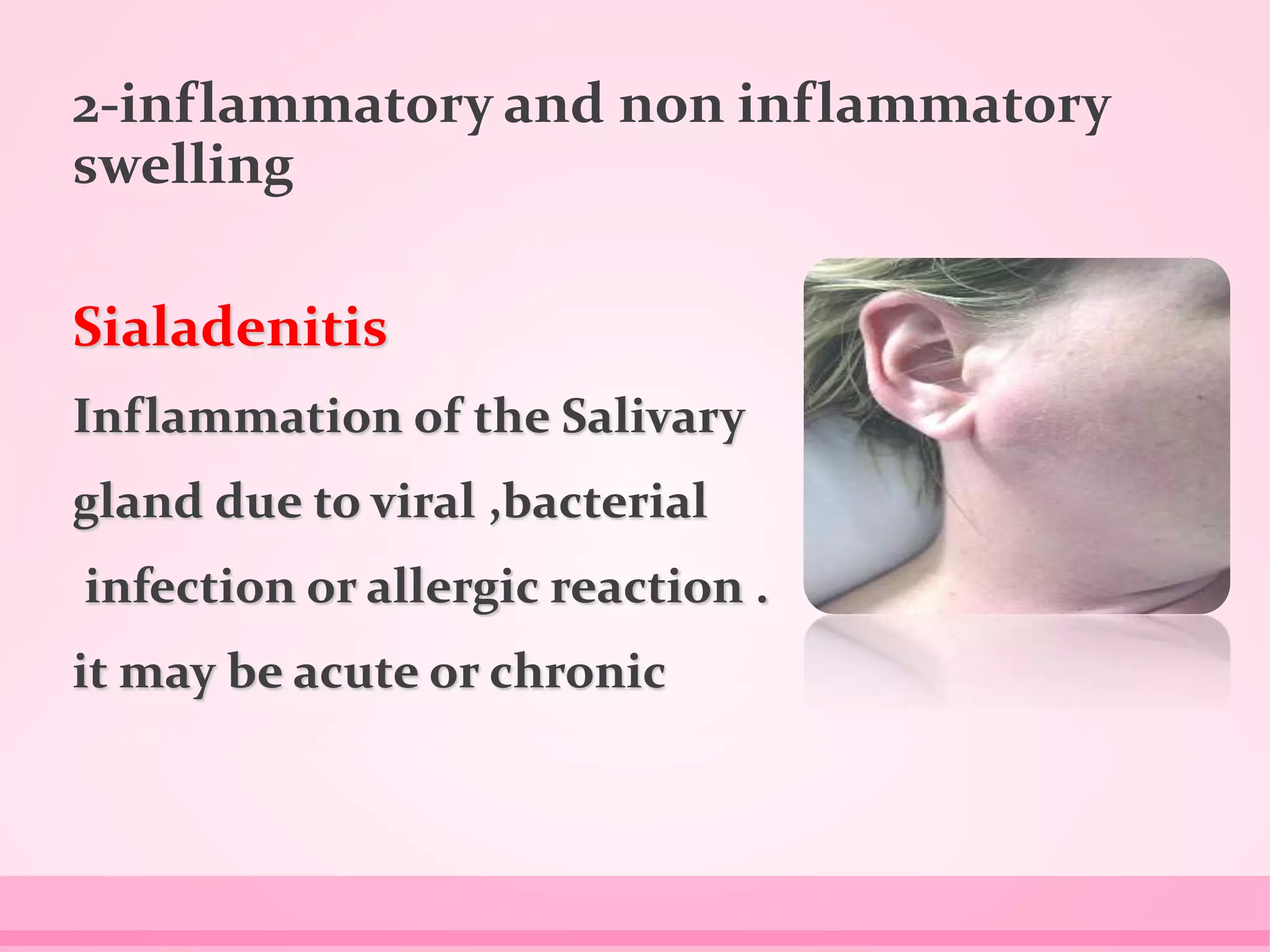 Salivary gland diseases | PPTX