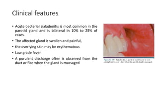 Salivary Gland Diseases - A Summary.pptx