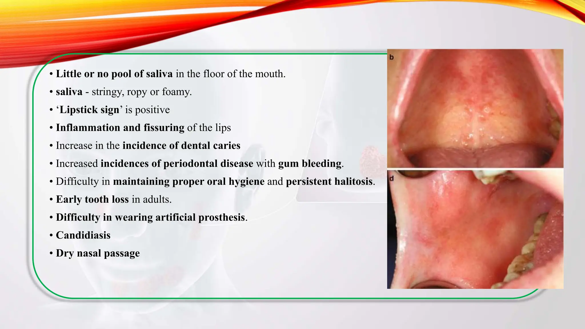 MAJOR SALIVARY GLAND DISORDERS- DIAGNOSIS AND INVESTIGATIONS | PPTX