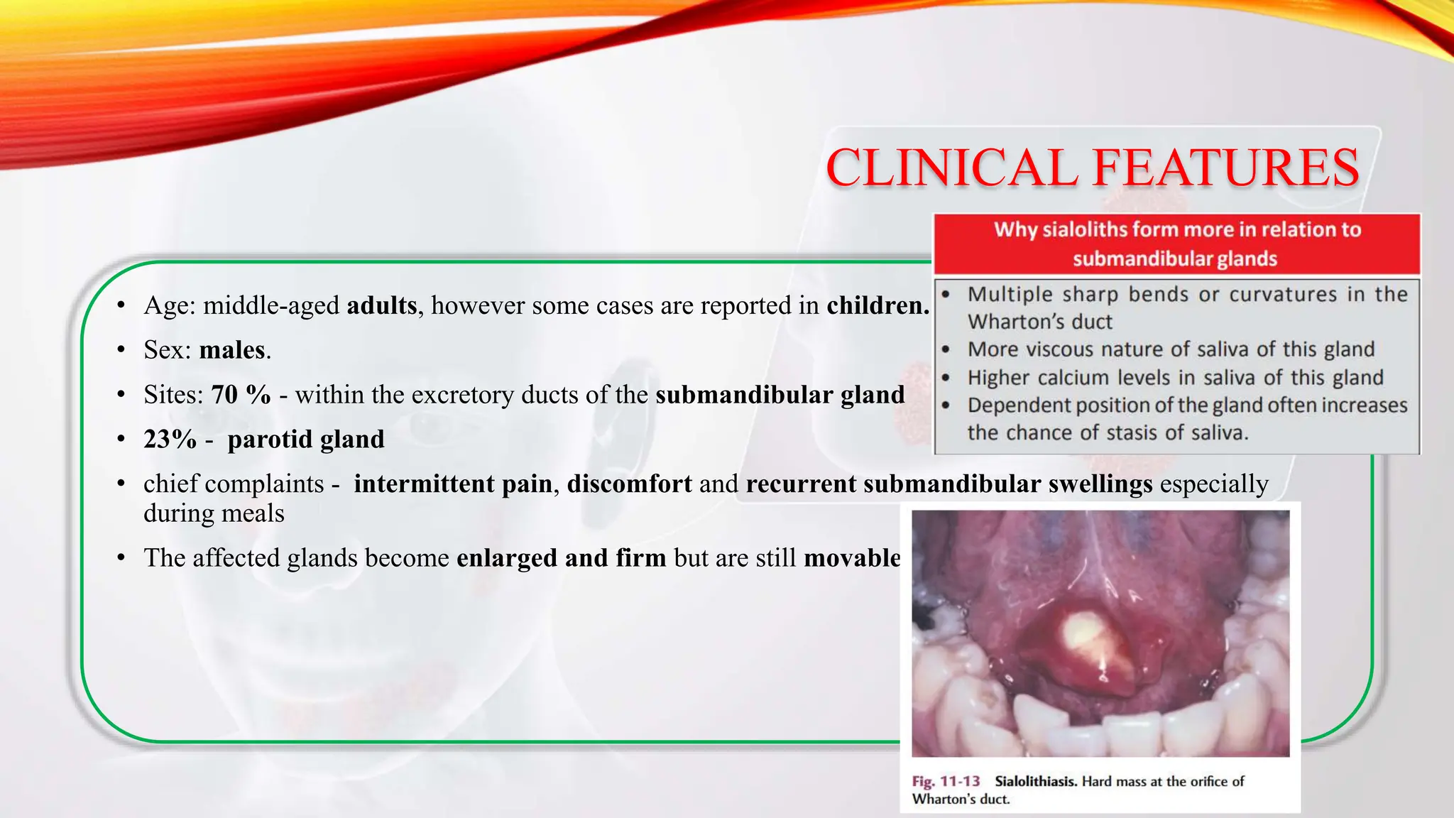 MAJOR SALIVARY GLAND DISORDERS- DIAGNOSIS AND INVESTIGATIONS | PPTX | Ear, Nose and Throat ...
