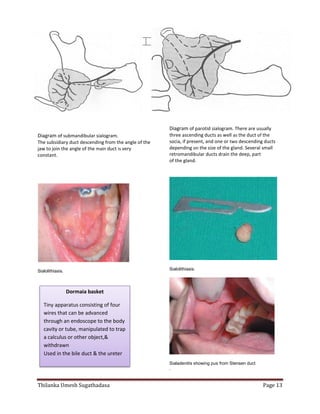 Salivary gland disorders | PDF