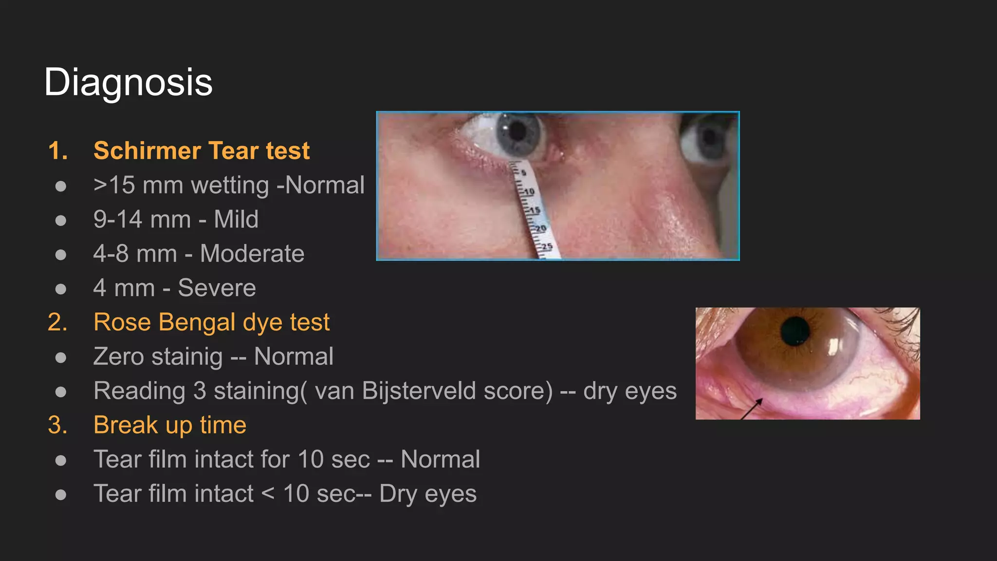 Salivary gland disorders | PDF