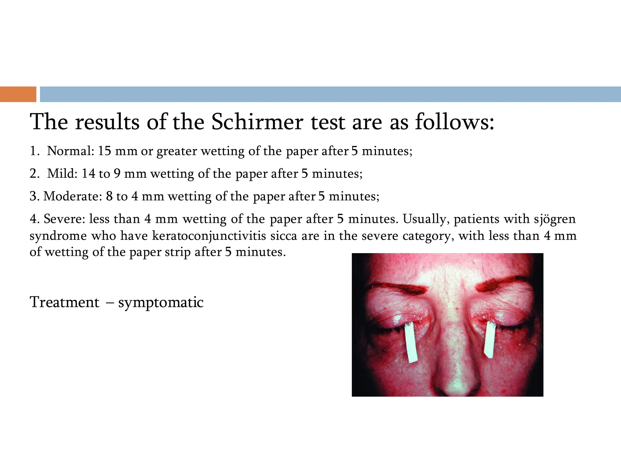 salivary gland disorders.pdf nothing more | PDF