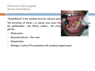 salivary gland disorders.pdf nothing more | PDF