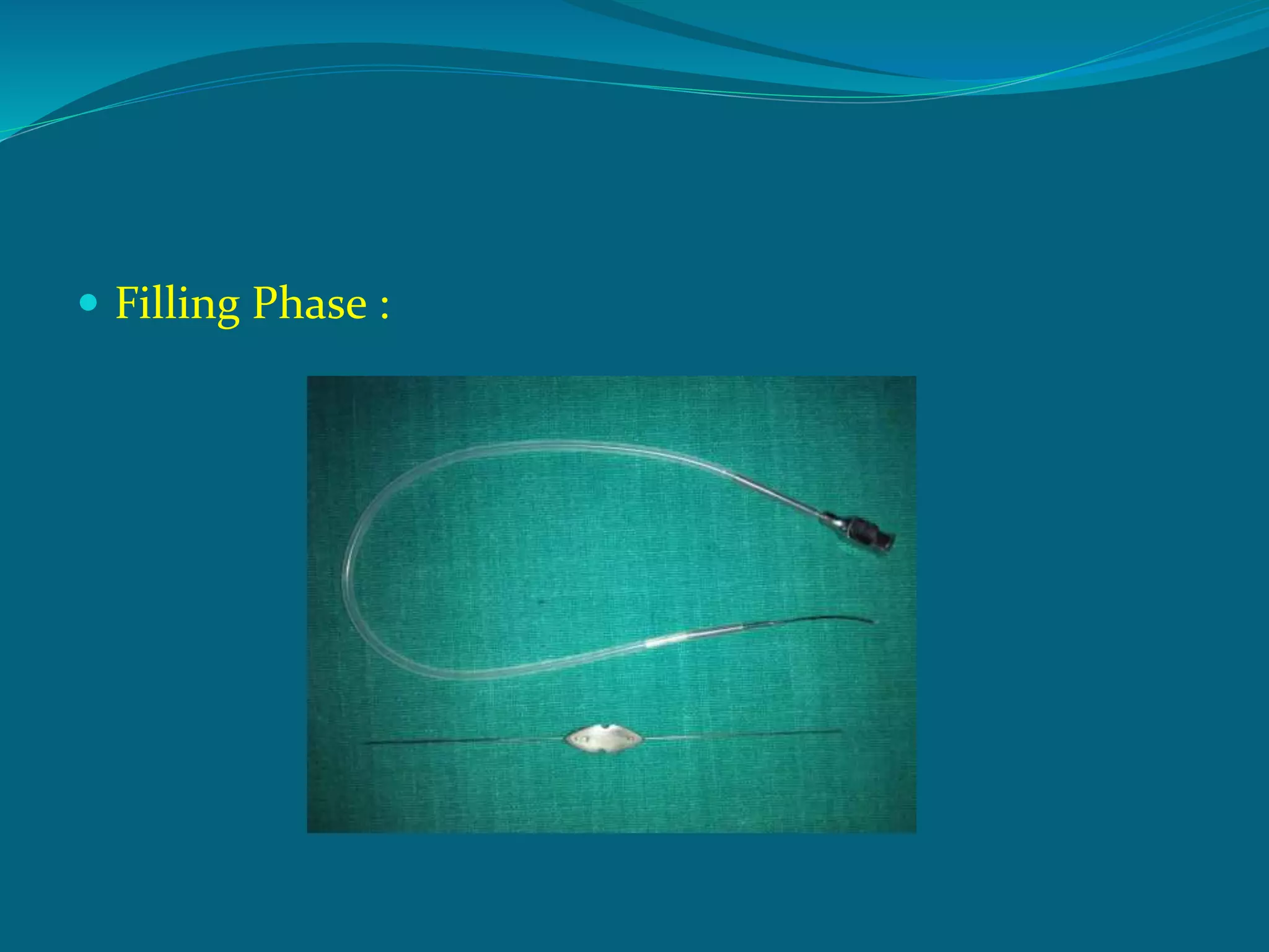 Salivary gland imaging | PPTX
