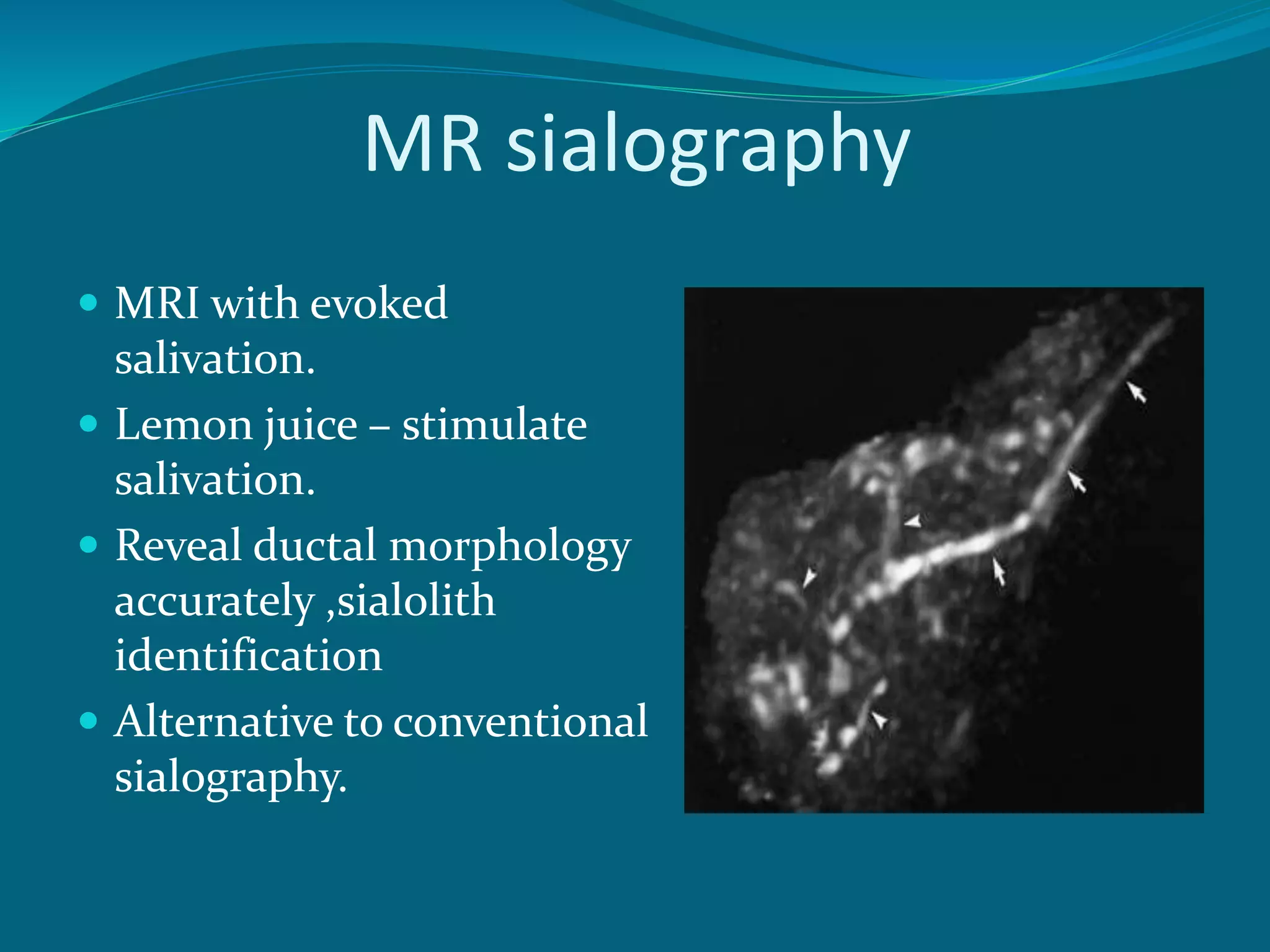 Salivary gland imaging | PPTX