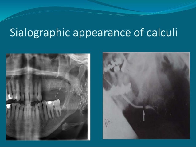 Salivary gland imaging