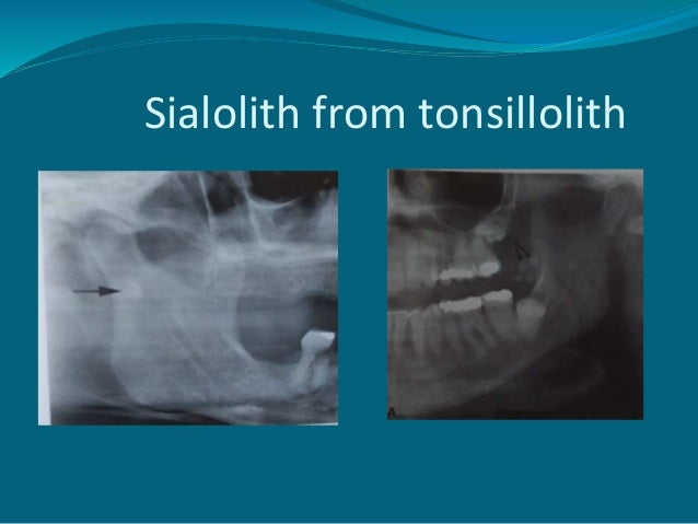 Salivary gland imaging