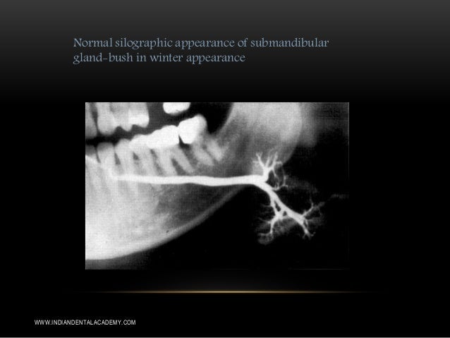 Salivary gland imaging / dental courses
