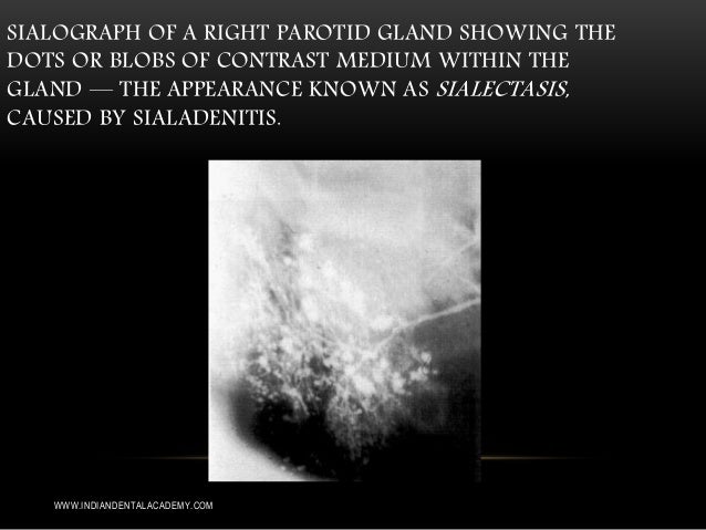 Salivary gland imaging / dental courses