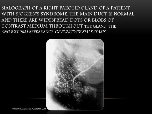 Salivary gland imaging / dental courses