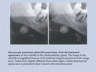 Salivary gland imaging | PPTX