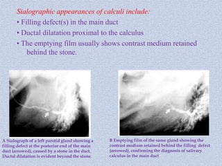 Salivary gland imaging | PPTX