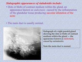 Salivary gland imaging | PPTX