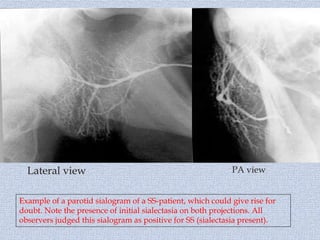Salivary gland imaging | PPTX
