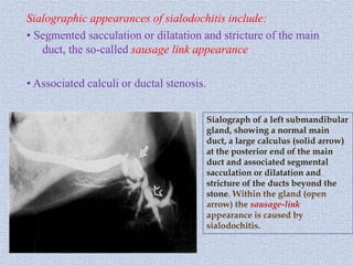 Salivary gland imaging | PPT