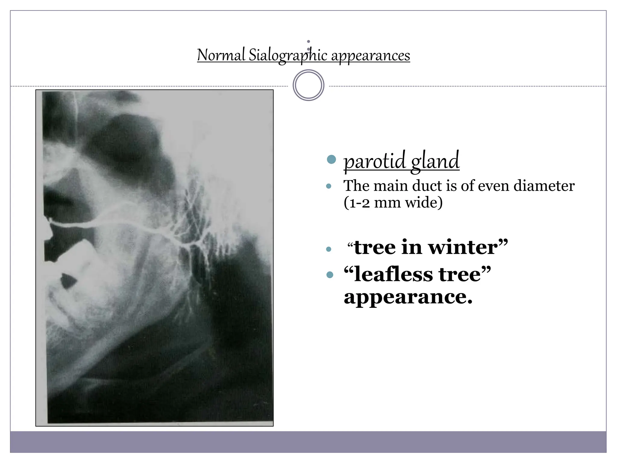 salivary gland radiologic imaging doc.pptx