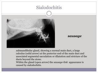 salivary gland radiologic imaging doc.pptx