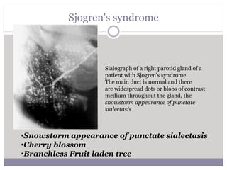 salivary gland radiologic imaging doc.pptx