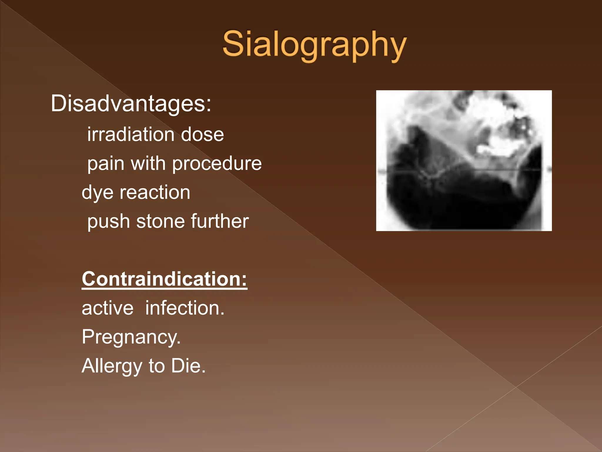 Salivary gland Imaging-asif-434.ppt