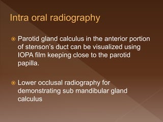 Salivary gland Imaging-asif-434.ppt
