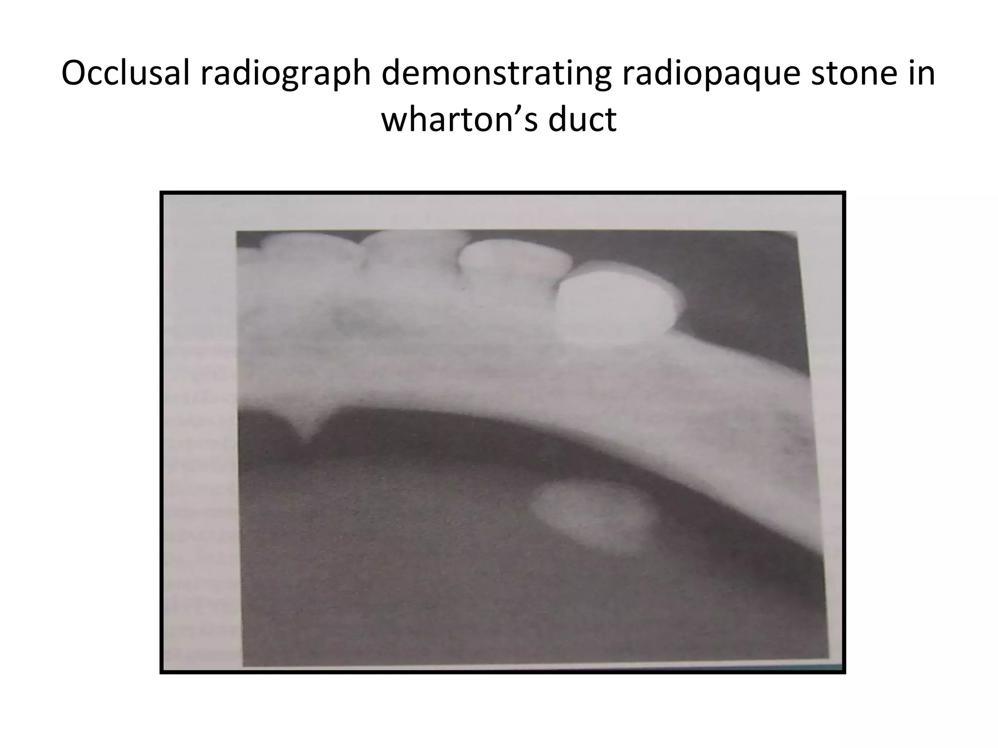 Salivary gland imaging and sialochemistry (radiological and ...