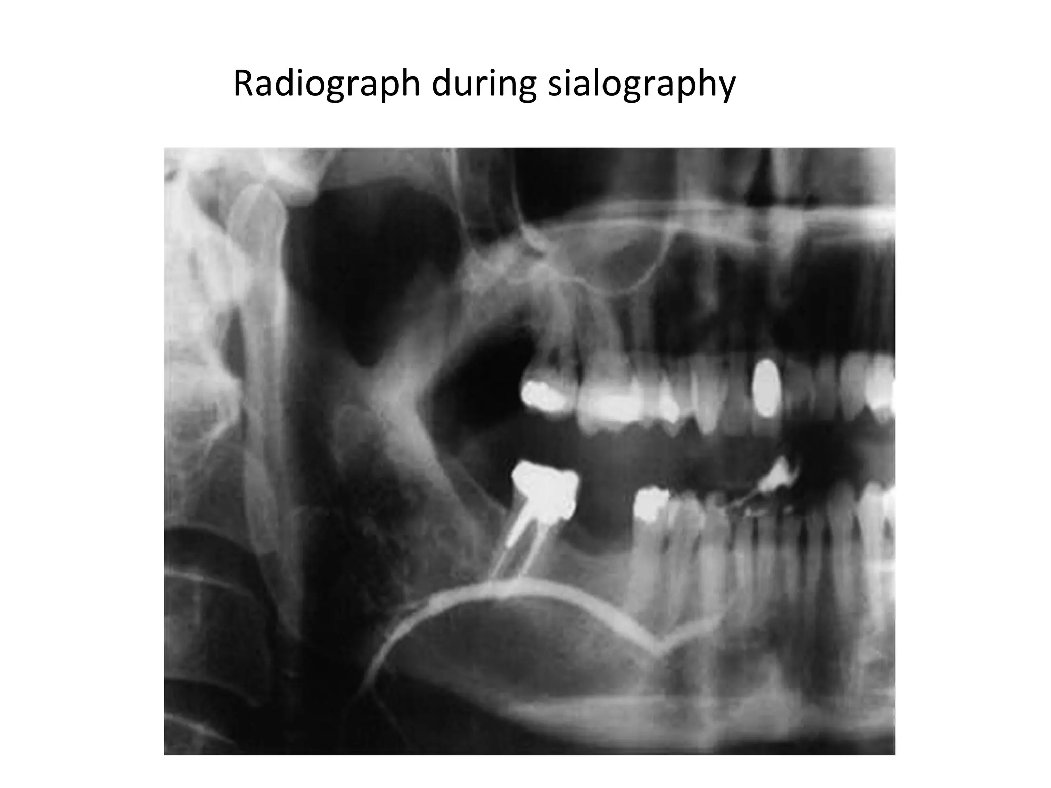 Salivary gland imaging and sialochemistry (radiological and ...