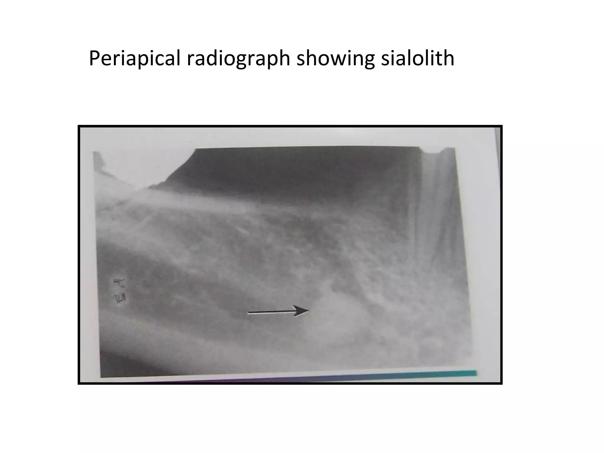 Salivary gland imaging and sialochemistry (radiological and ...