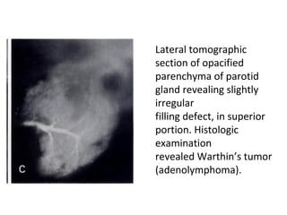 Salivary gland imaging and sialochemistry (radiological and ...