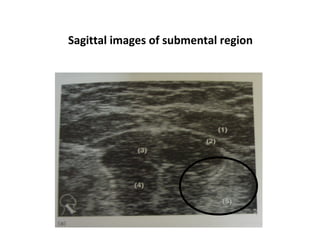 Salivary gland imaging and sialochemistry (radiological and ...