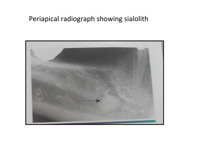 Salivary gland imaging and sialochemistry (radiological and ...