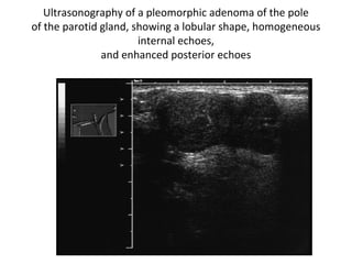 Salivary gland imaging and sialochemistry (radiological and ...