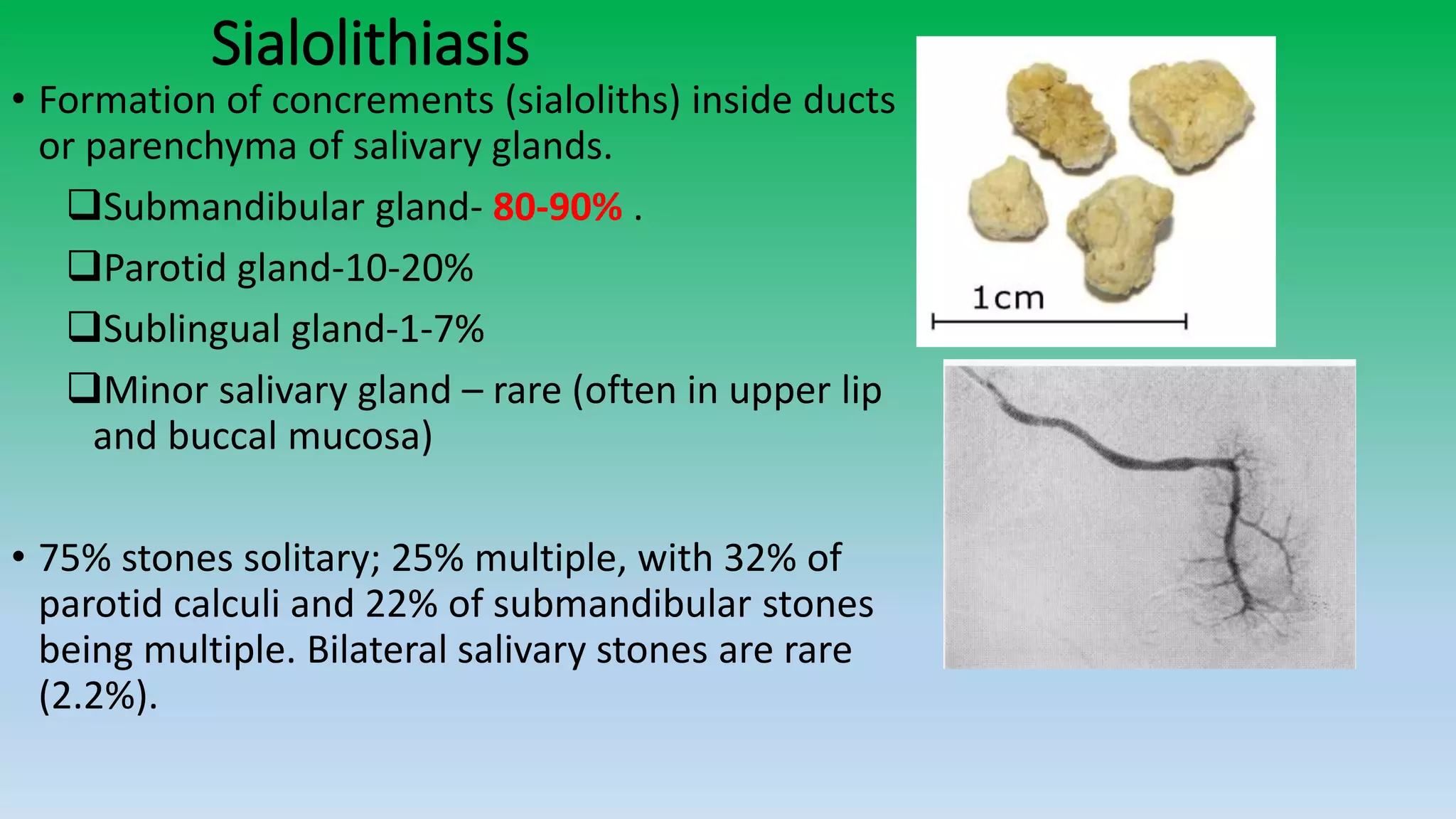 Salivary gland imaging radiology ppt | PPTX