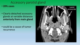 Parotid Gland Tumor Mri