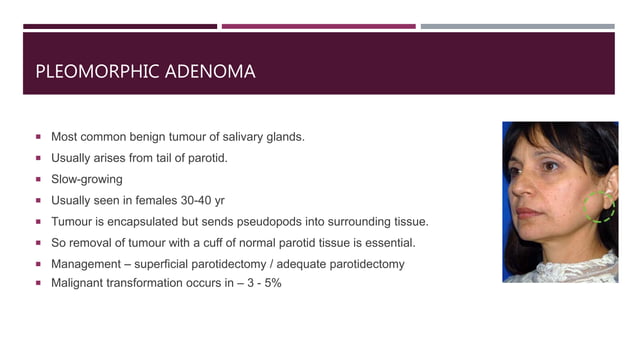 Salivary gland and its disorders Dr Utkal Mishra | PPT