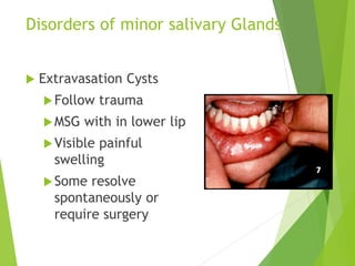 salivary gland investigation and management.ppt