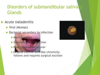 salivary gland investigation and management.ppt