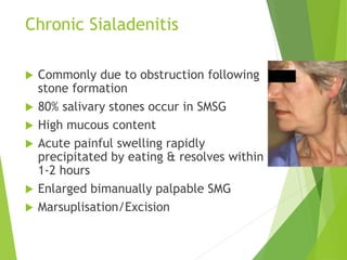 salivary gland investigation and management.ppt